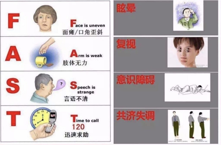 “FAST”这个救命的识别法则你一定要知道！