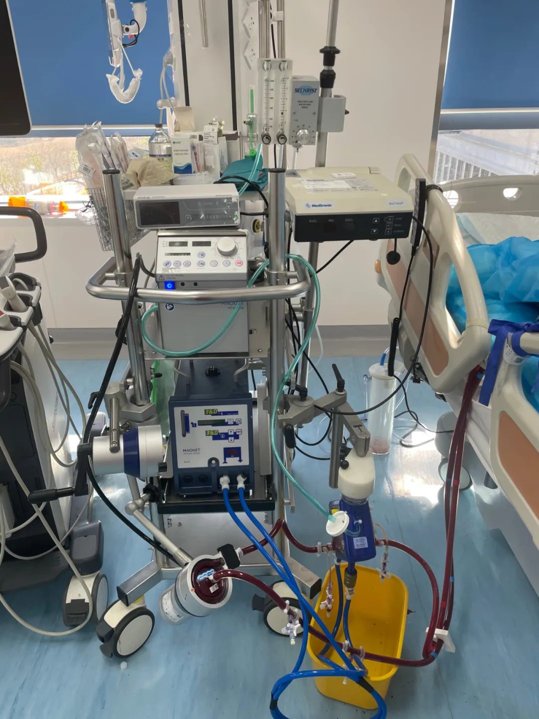 首次实现两台ECMO同时运转！金山医院为更多危重症患者“抢命”