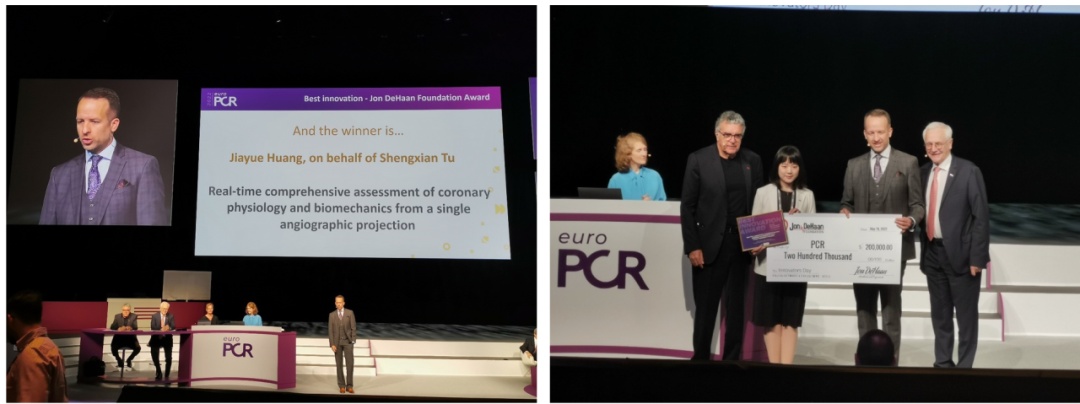 冠心病精准评估添“利器”｜上海市科学技术奖