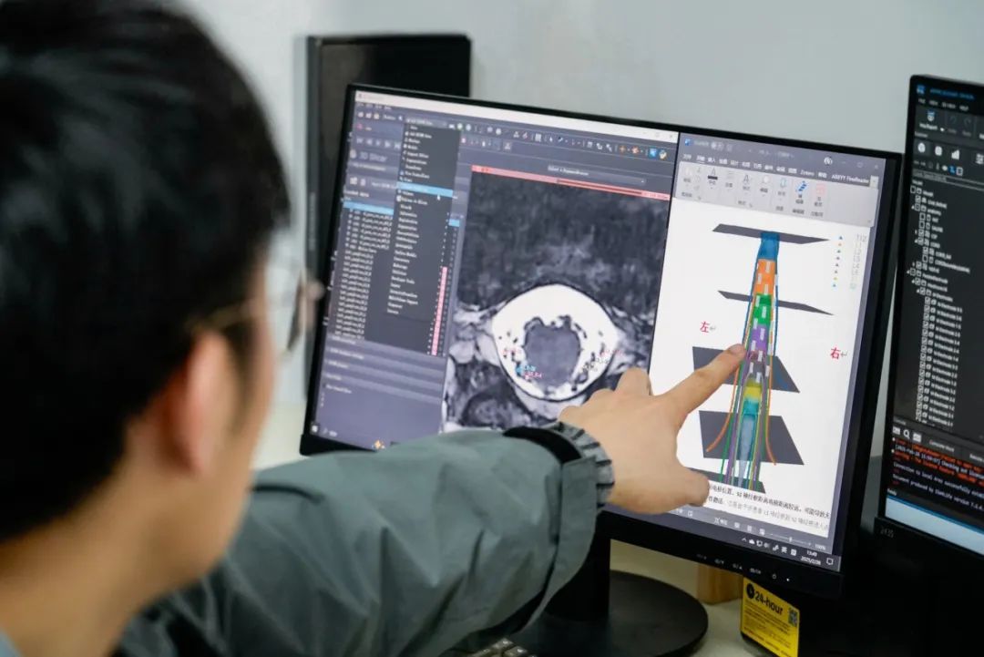 复旦AI4S重磅突破！脑脊接口让瘫痪者重新行走！